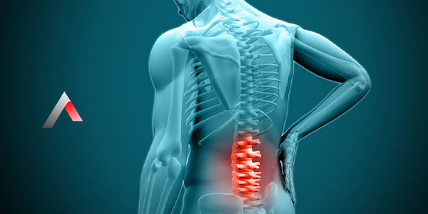 Açık Bel Fıtığı Ameliyatı | A Life Sağlık Grubu