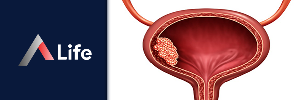 Cystolithotomy Procedure | A Life Health Group