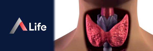 Haşimato Nedir? Haşimato Belirtileri Nelerdir? | A Life Sağlık Grubu