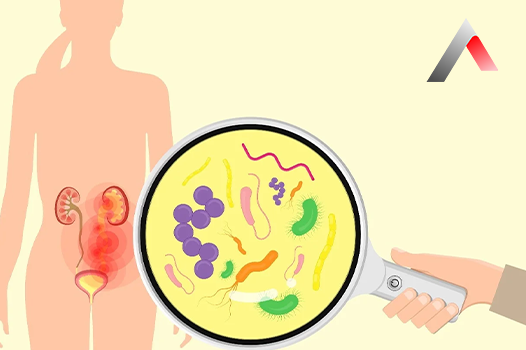 Kadınlarda İdrar Yolu Enfeksiyonuna Ne İyi Gelir? | A Life Sağlık Grubu