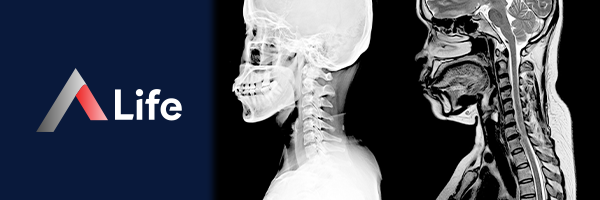 Servikal MR | A Life Sağlık Grubu