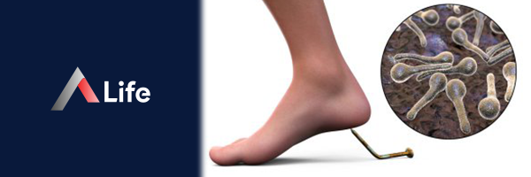 Tetanoz Nedir? Tetanoz Aşısı Nedir? | A Life