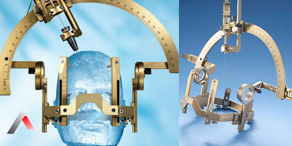 Stereotactic Surgery | A Life Health Group